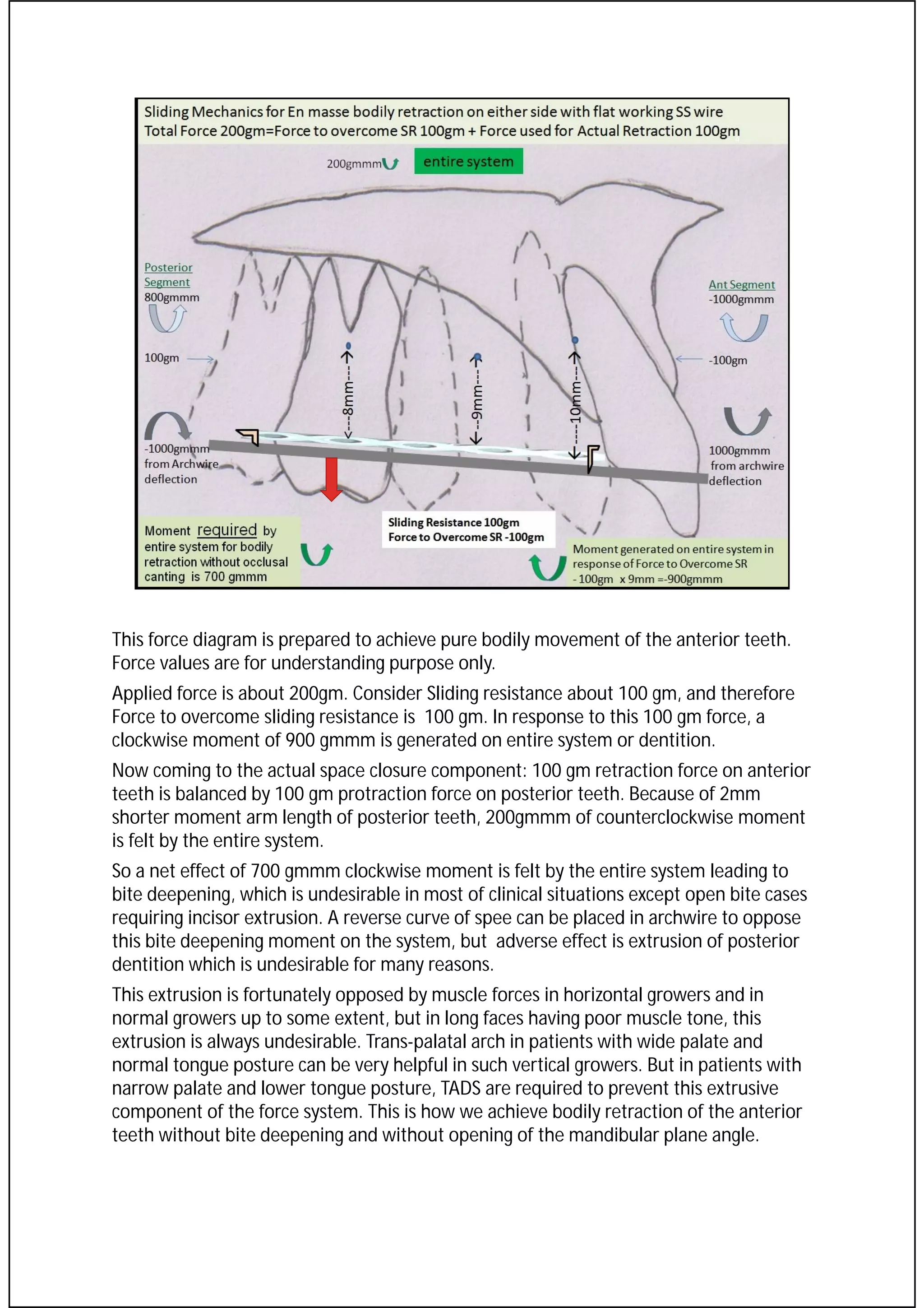 Orthodontic retraction biomechanics for space closure and distalization ...