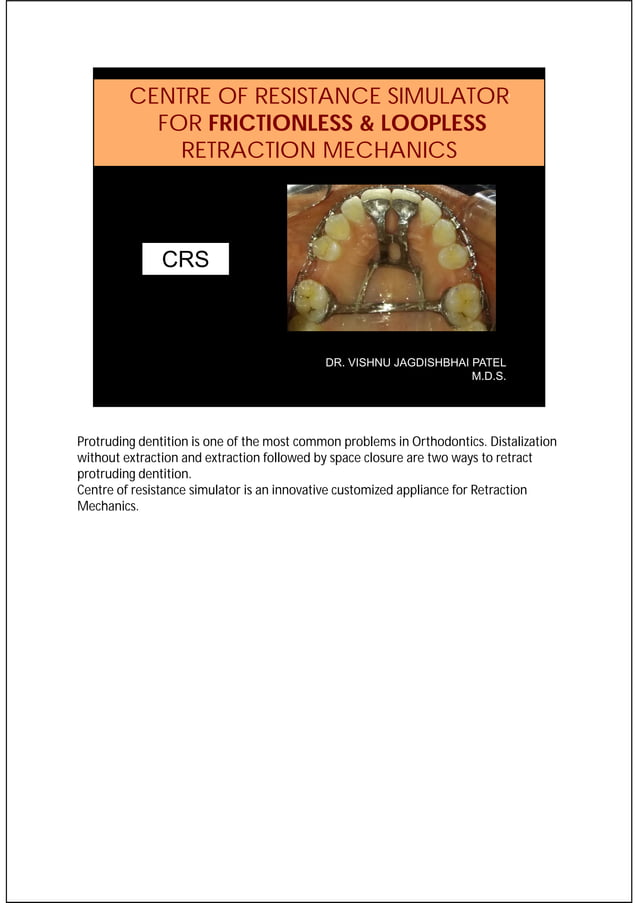 Orthodontic retraction biomechanics for space closure and distalization ...