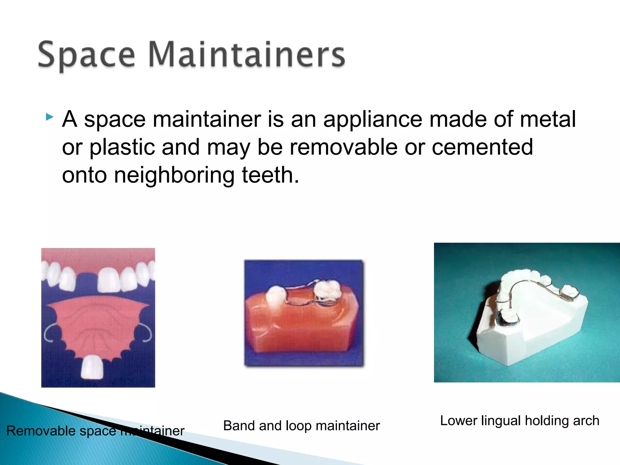 Intro To Orthodontics | PPT