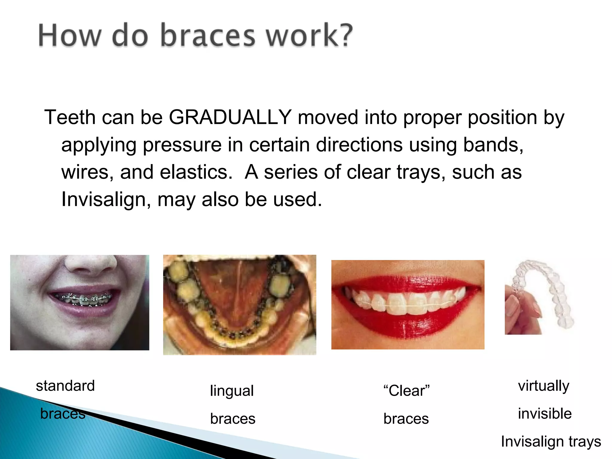 Intro To Orthodontics | PPT