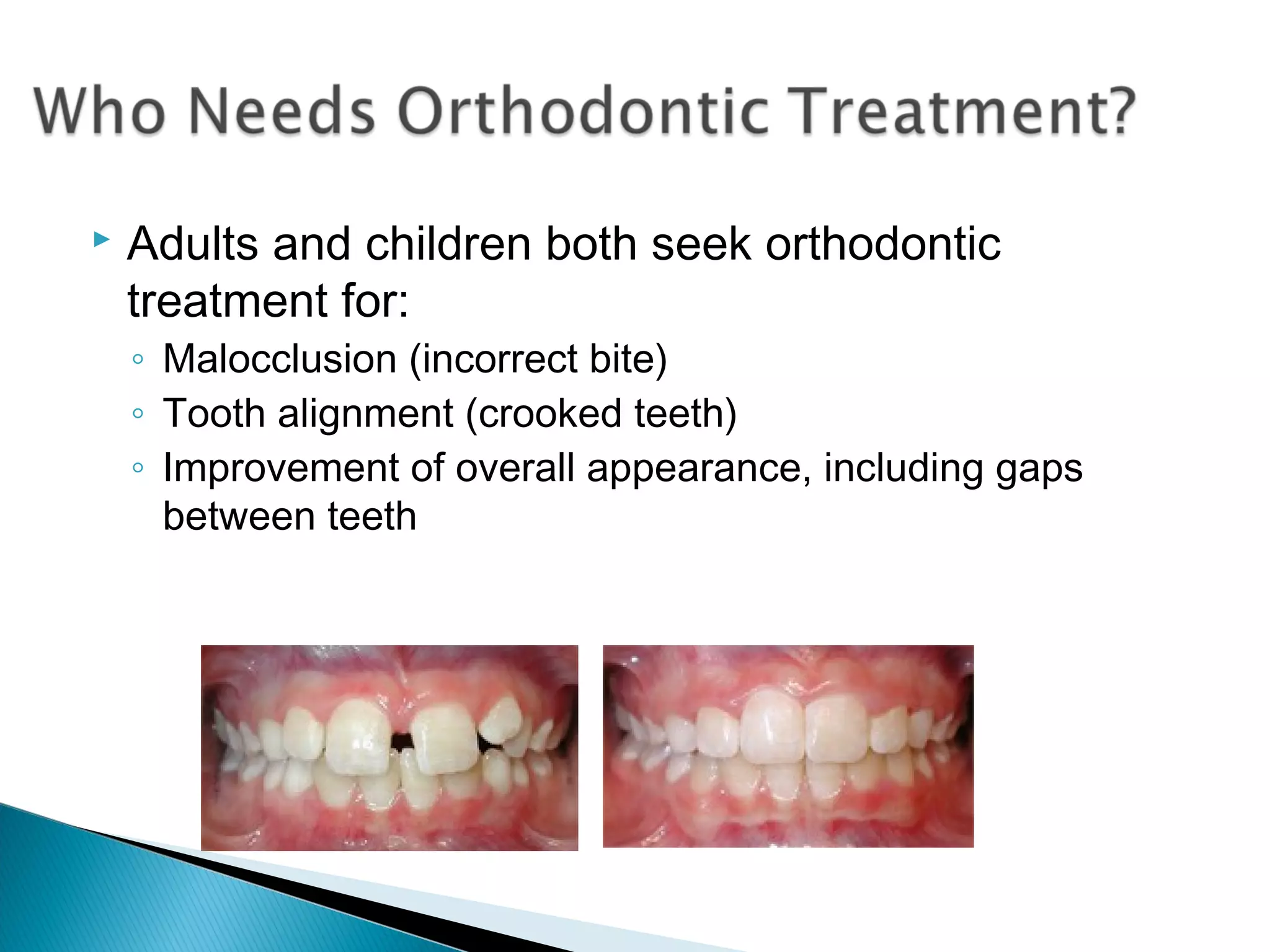 Intro To Orthodontics | PPT