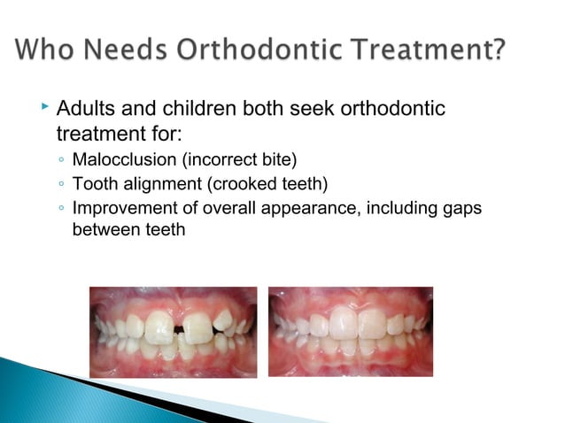 Intro To Orthodontics | PPT