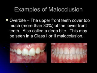 Orthodontics | PPT