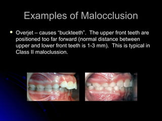 Orthodontics | PPT