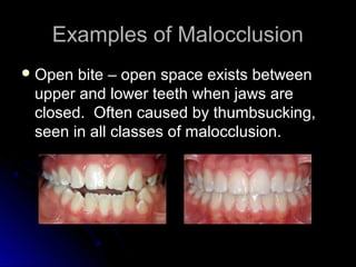 Orthodontics | PPT