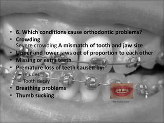Orthodontics | PPT