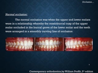 ORTHODONTICS-section-2-classification-of-malocclusion-lecture (1).pptx