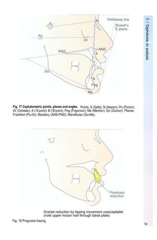 Orthodontics and paediatric dentistry | PDF