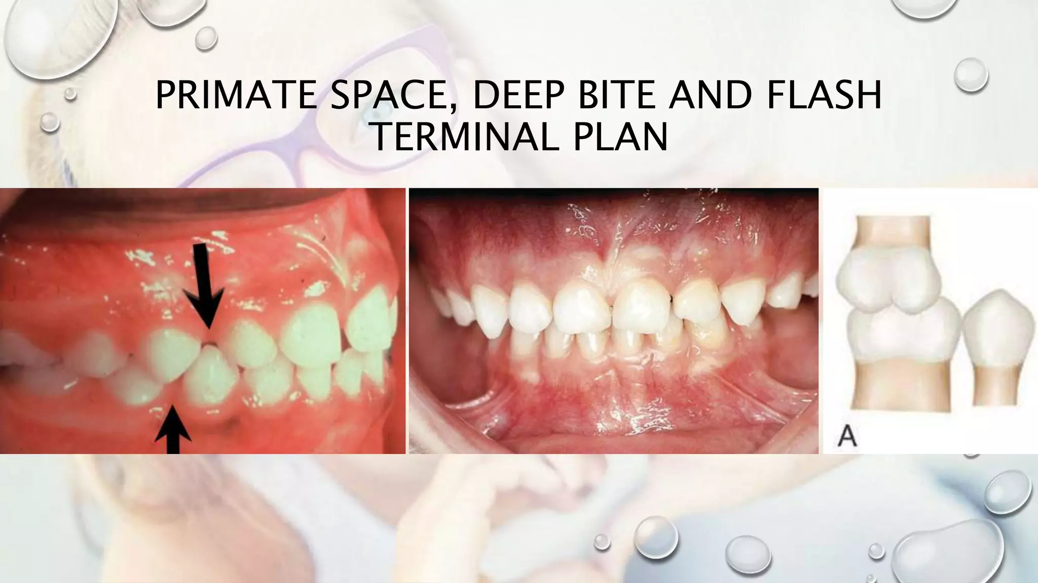 Orthodontics At A Glance.pptx