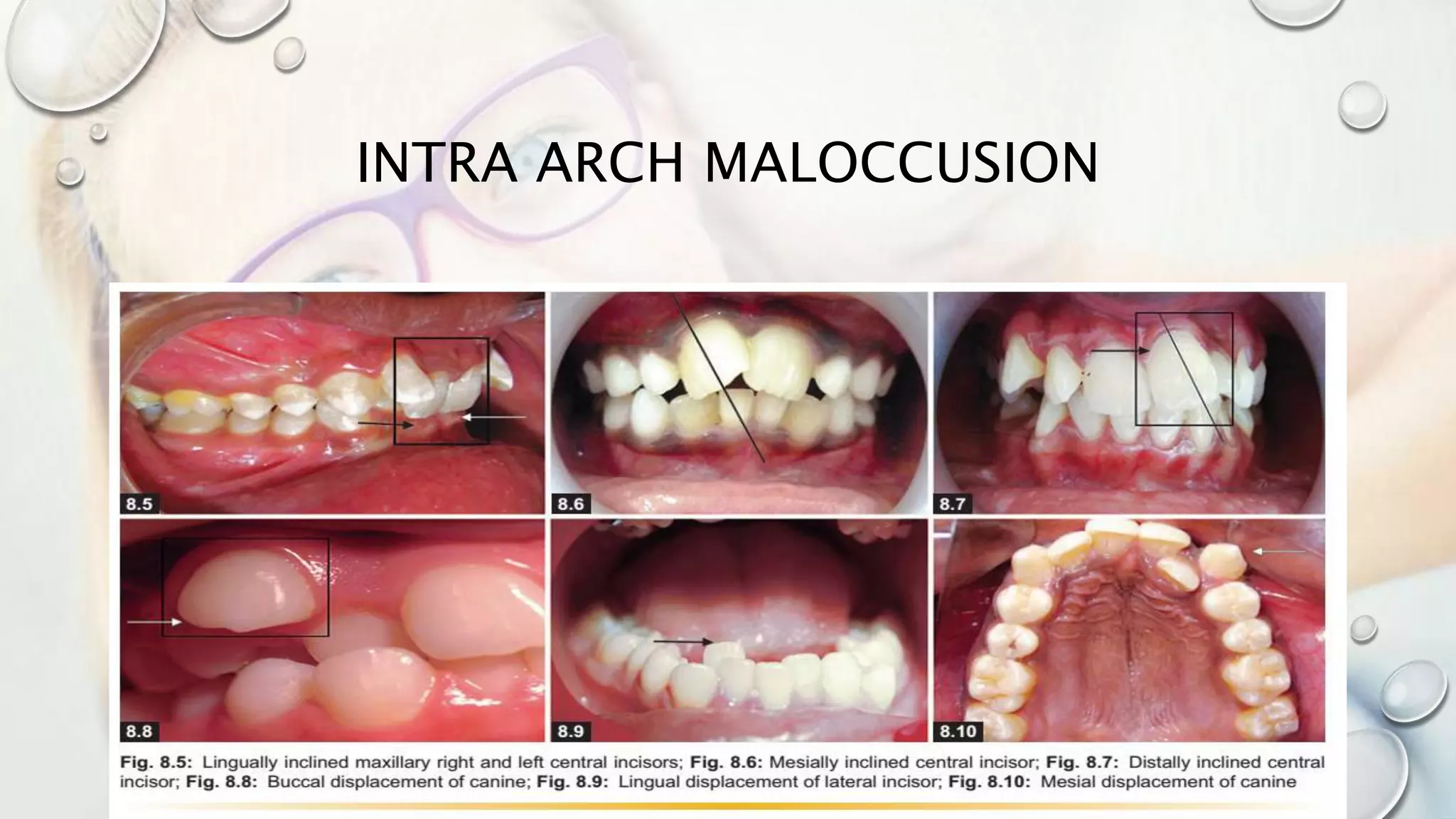 Orthodontics At A Glance.pptx