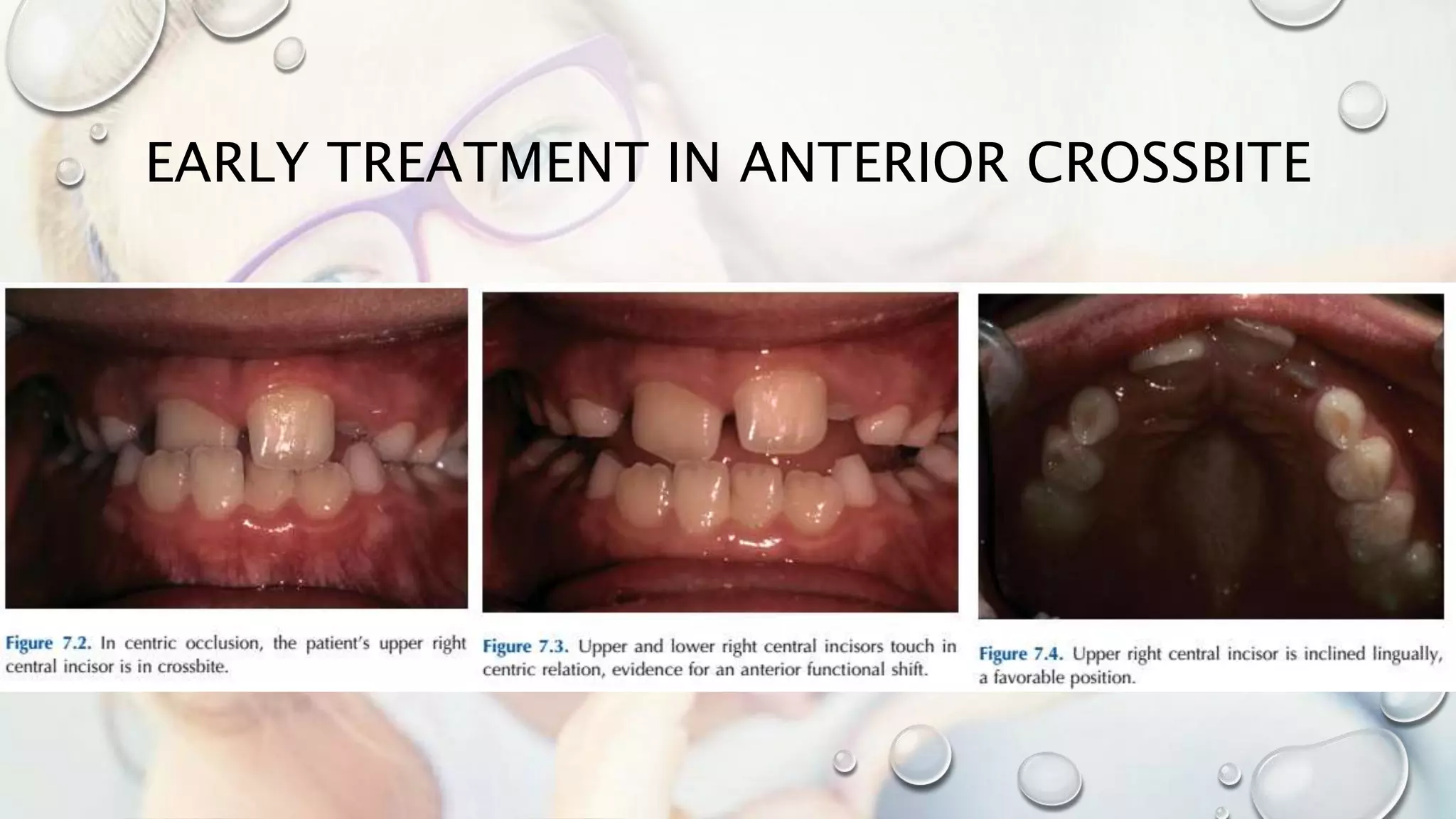 Orthodontics At A Glance.pptx