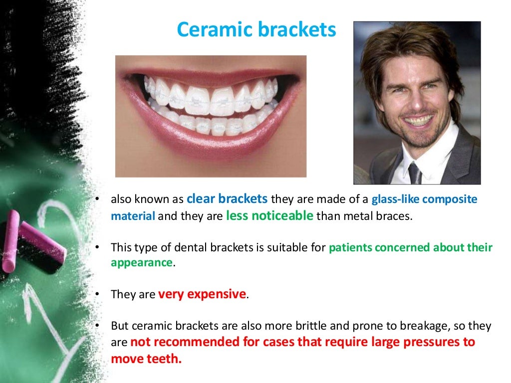 Orthodontics brackets removal