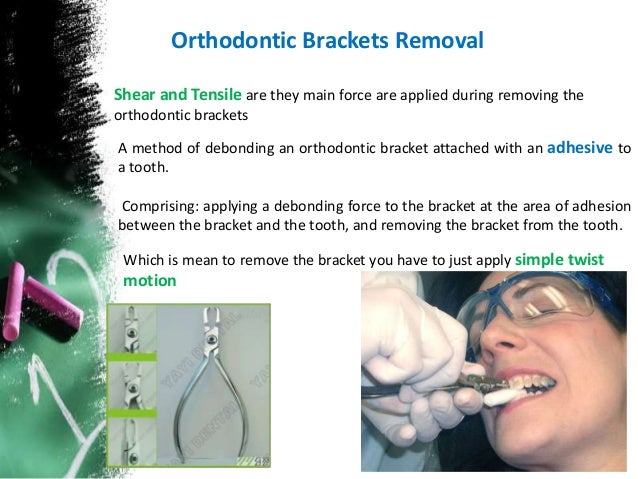 Orthodontics brackets removal