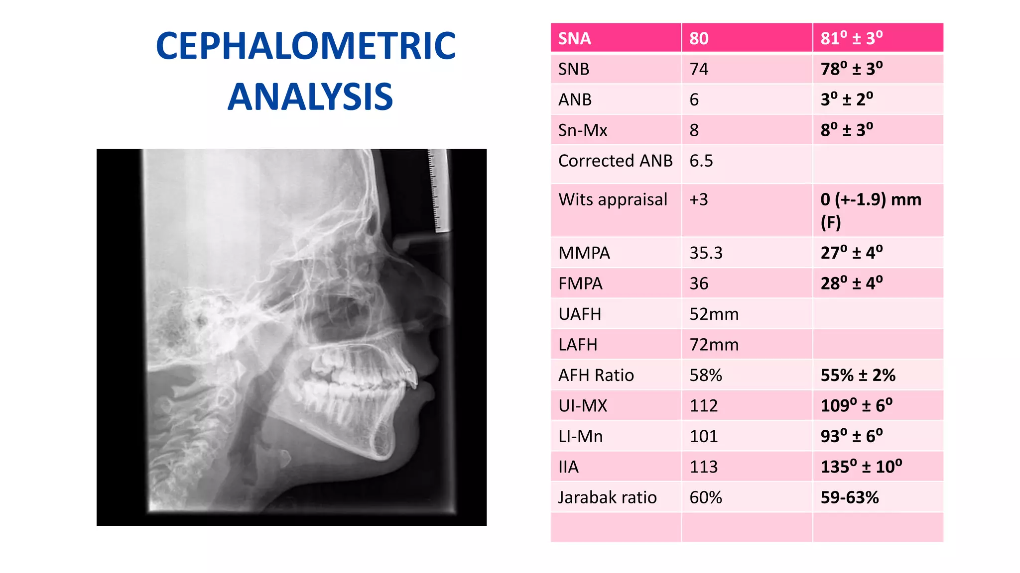 Orthodonticscasepresentation yasmin-hzayyen | PPTX