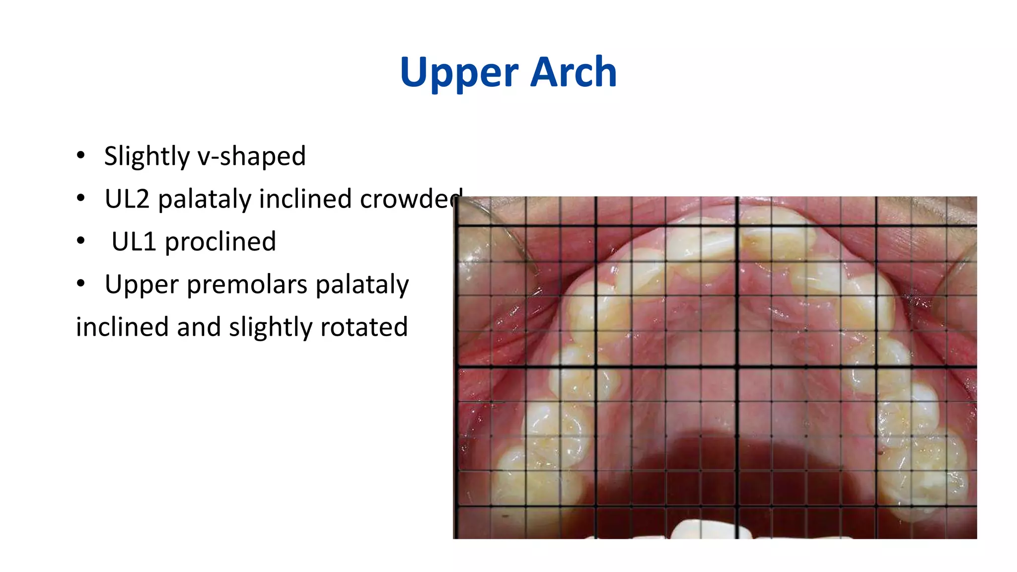 Orthodonticscasepresentation yasmin-hzayyen | PPTX