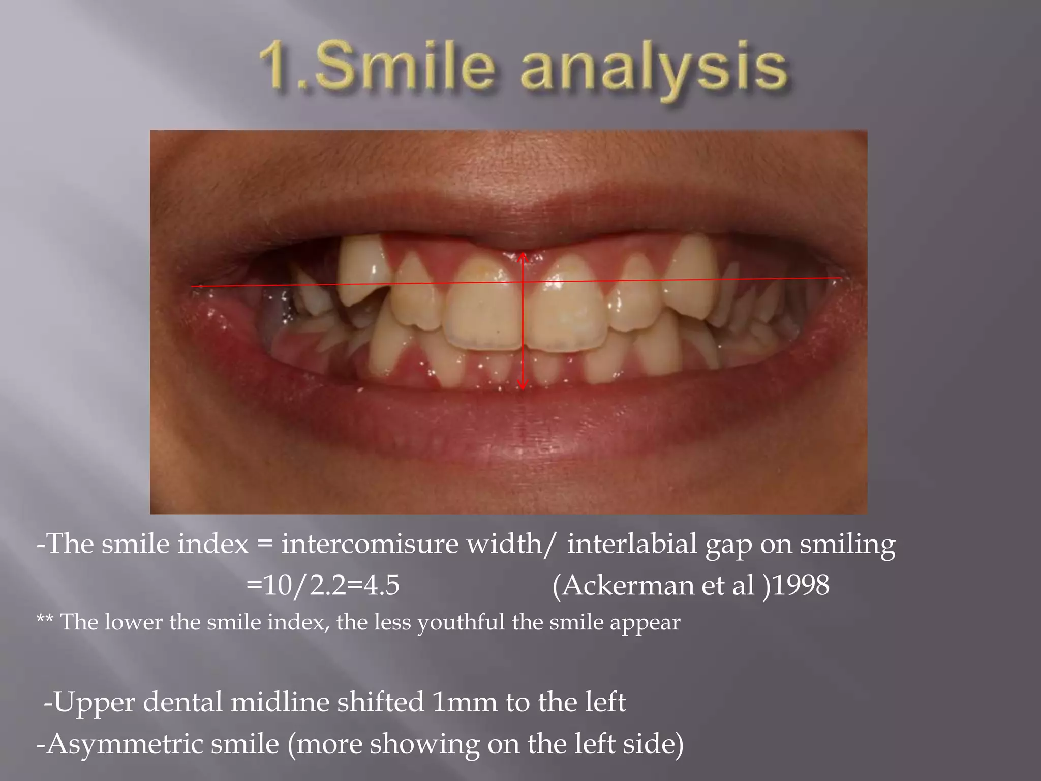 Orthodontics case presentation Dr-noor haddadin | PPTX