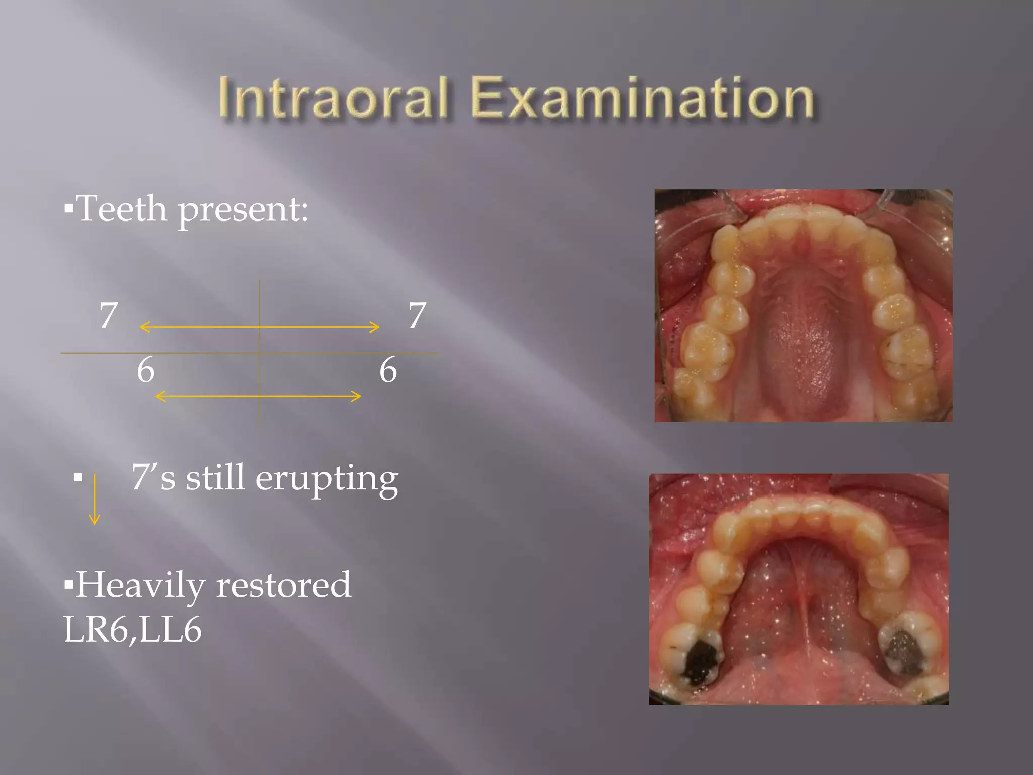 Orthodontics case presentation Dr-noor haddadin | PPTX