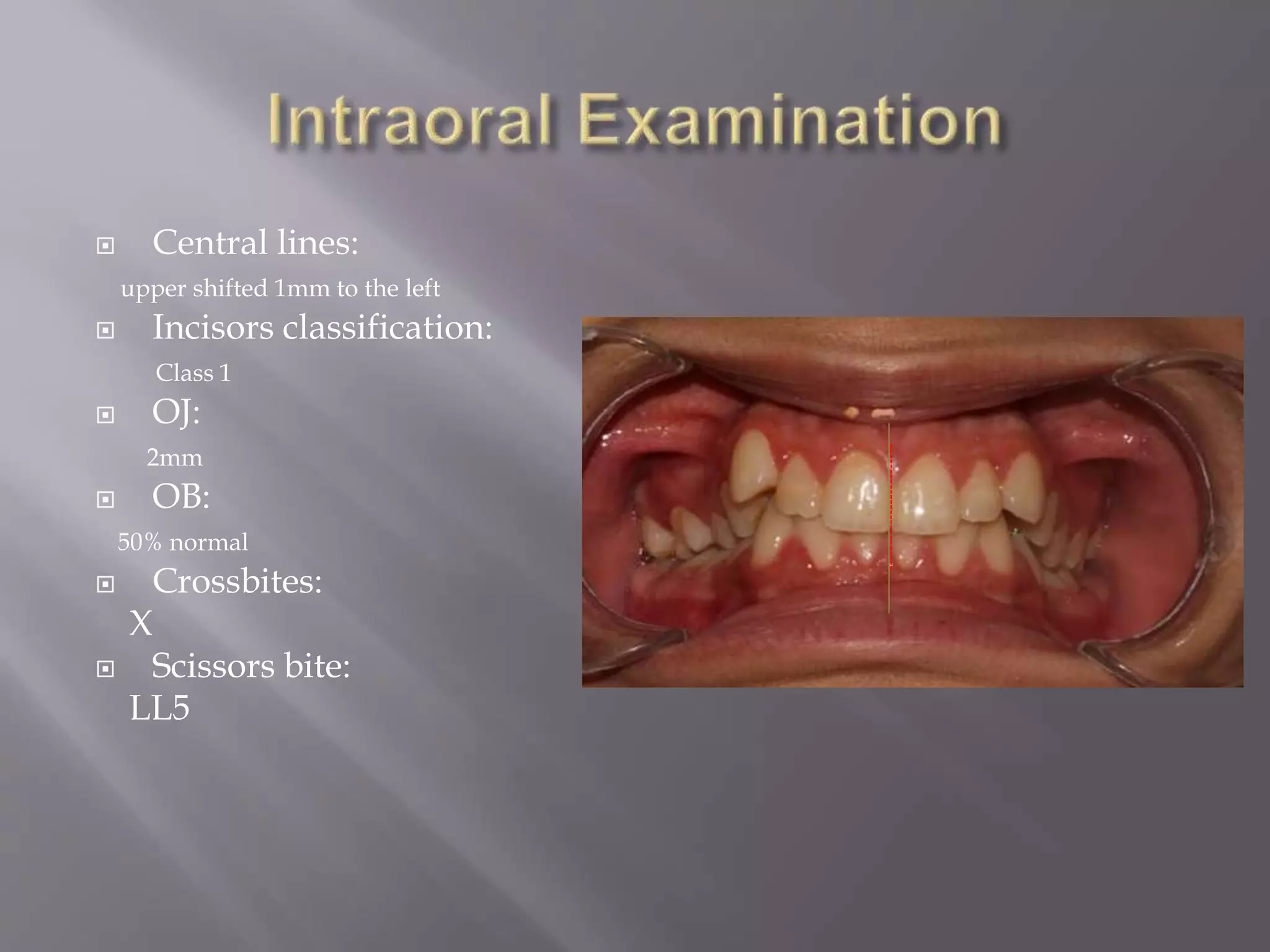Orthodontics case presentation Dr-noor haddadin | PPTX