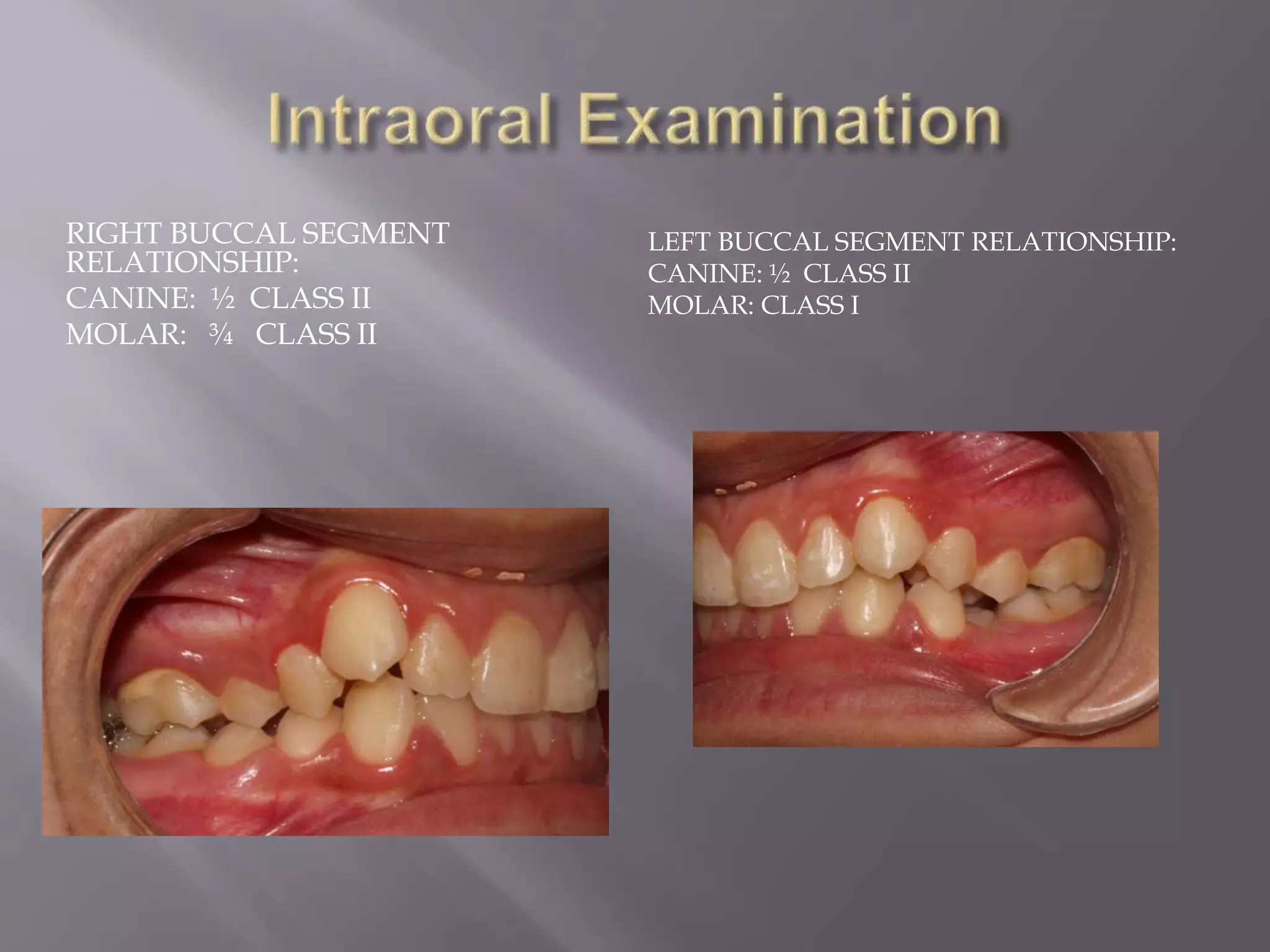 Orthodontics case presentation Dr-noor haddadin | PPTX
