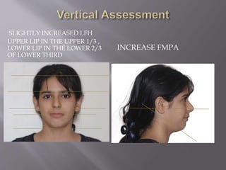 Orthodontics case presentation Dr-noor haddadin | PPT