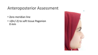 Orthodontics case presentation pp yehya | PPTX