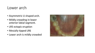 Orthodontics case presentation pp yehya | PPTX