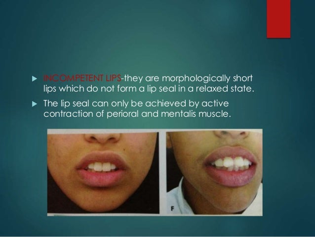 Orthodontics diagnosis