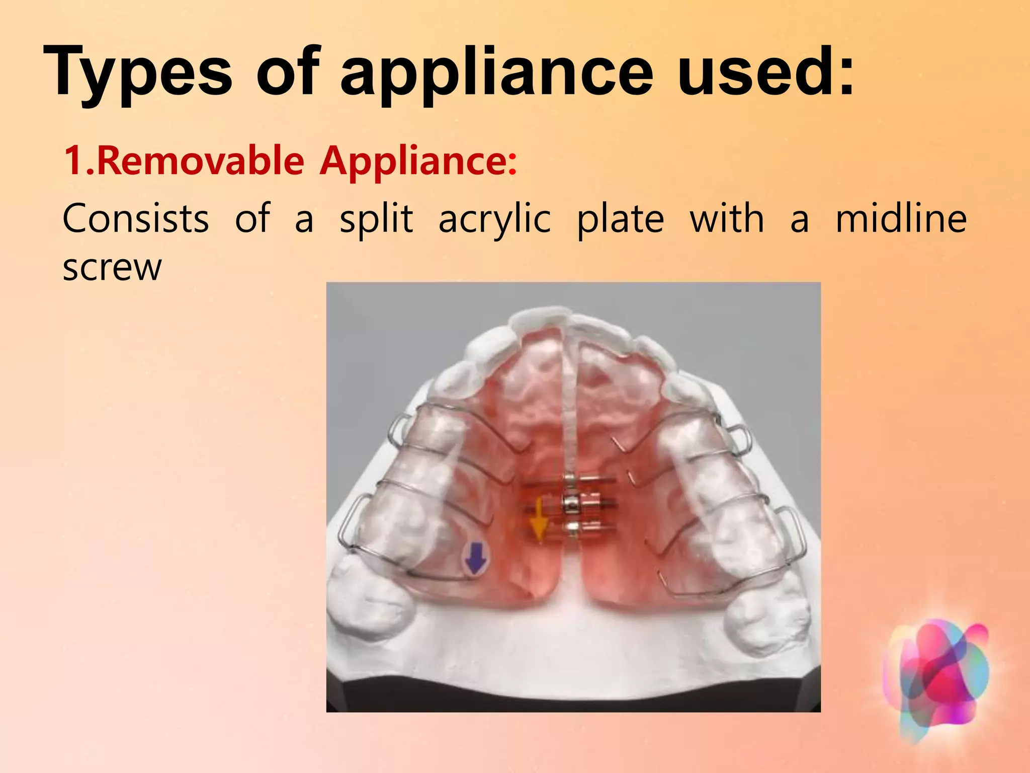 Introduction to maxillary arch expansion | PPTX
