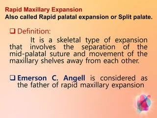 Introduction to maxillary arch expansion | PPTX