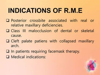 Introduction to maxillary arch expansion | PPTX