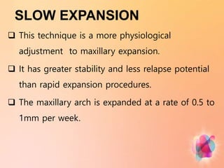 Introduction to maxillary arch expansion | PPTX