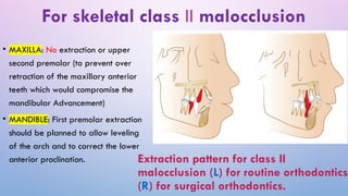 Orthodontics for Orthognathic surgery.pptx