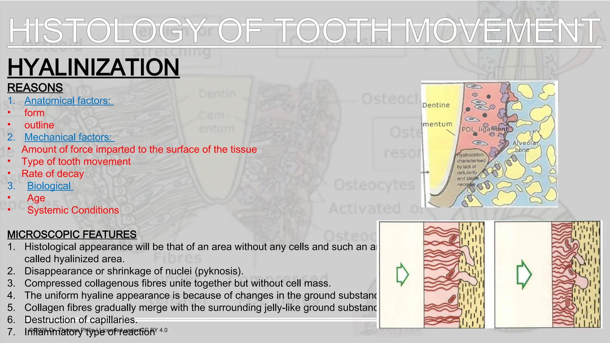 FORCE SYSTEMS AND TISSUE RESPONSE TO FORCES IN ORTHODONTICS.pptx