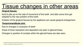 FORCE SYSTEMS AND TISSUE RESPONSE TO FORCES IN ORTHODONTICS.pptx