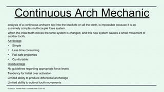 FORCE SYSTEMS AND TISSUE RESPONSE TO FORCES IN ORTHODONTICS.pptx