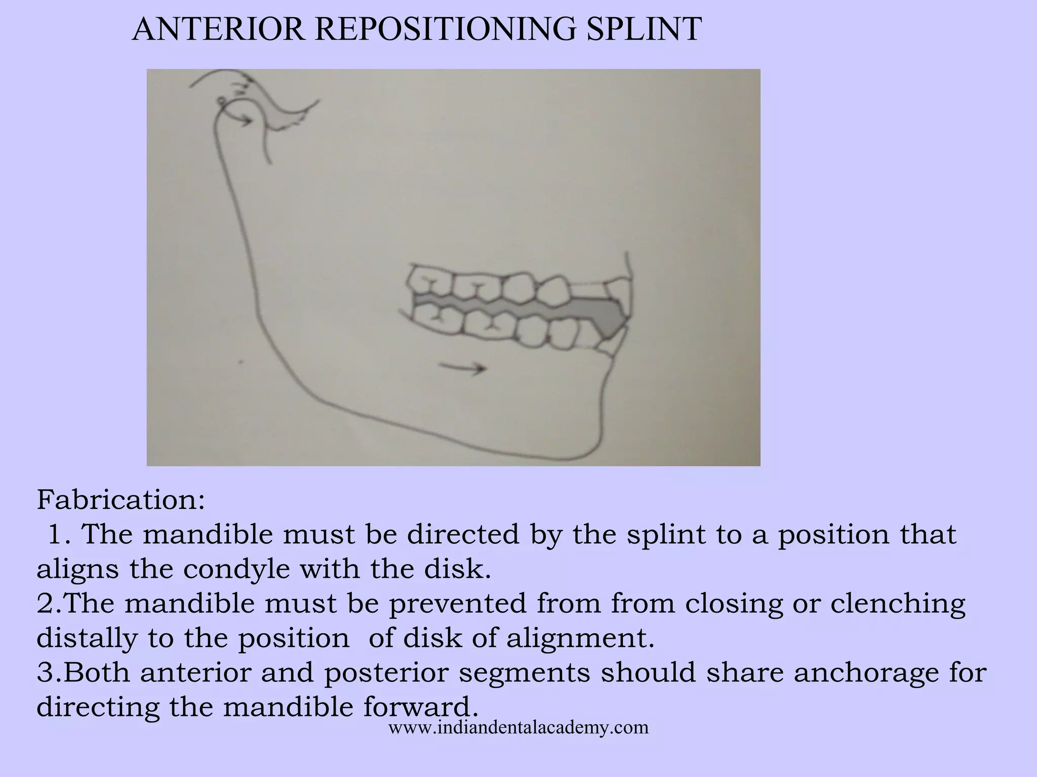 Orthodontic splints.. | PPT