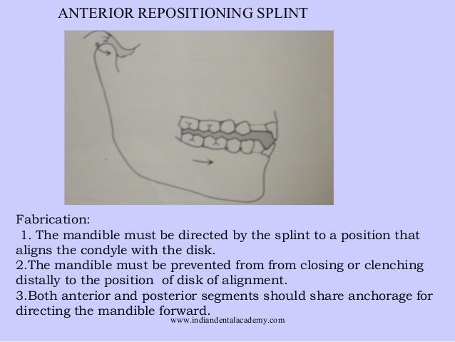 Orthodontic splints..
