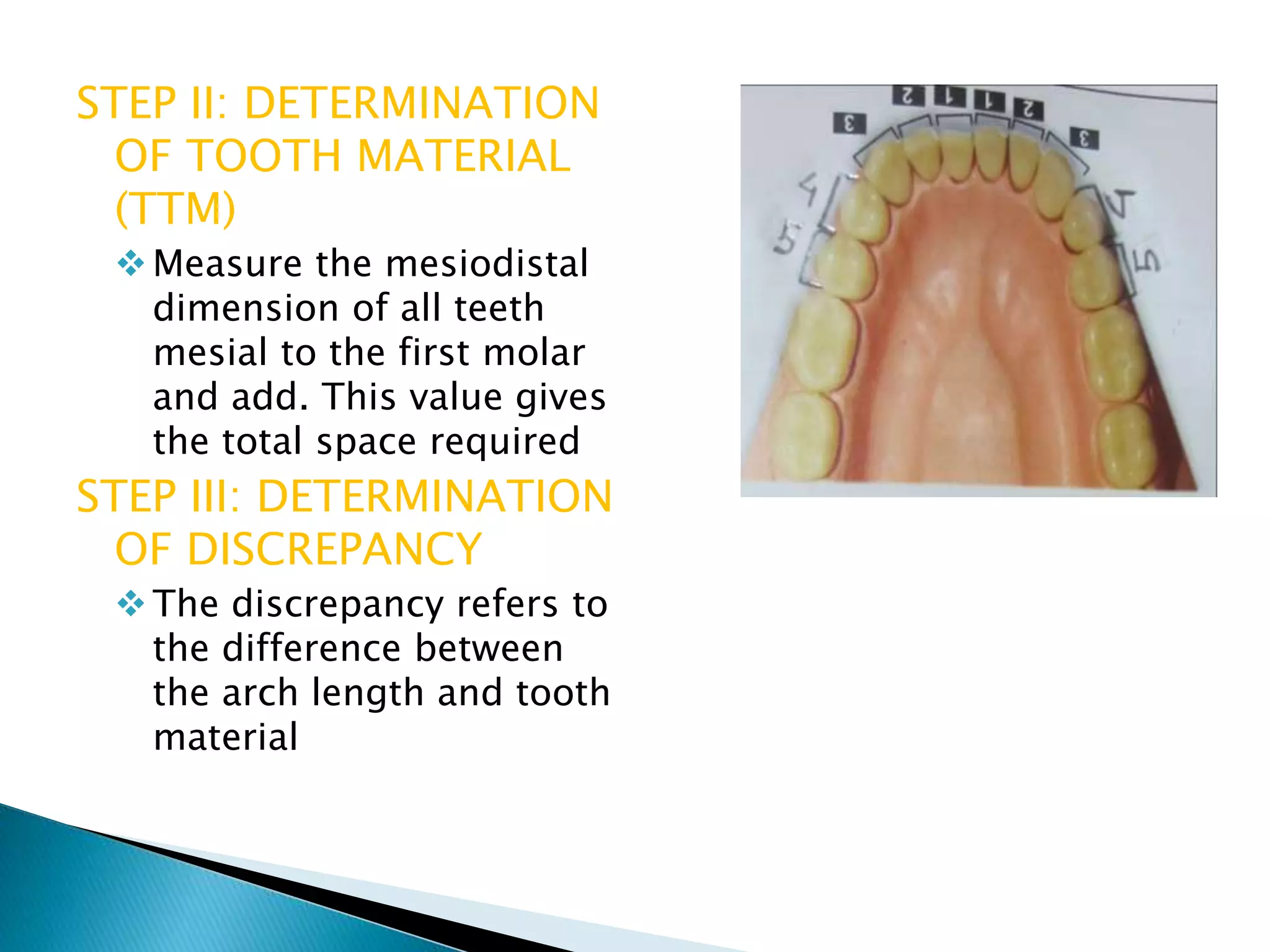 Orthodontic study model and model analysis | PPTX