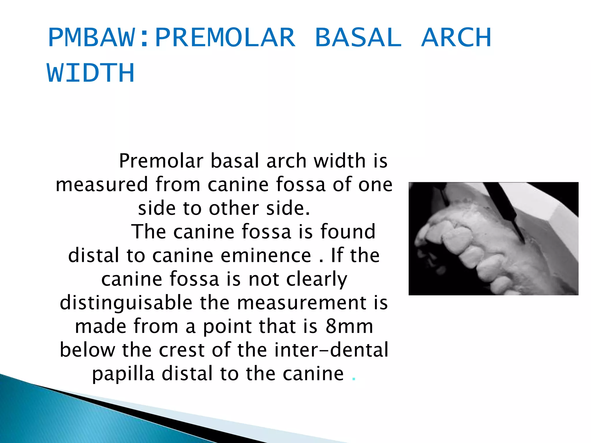 Orthodontic study model and model analysis | PPTX
