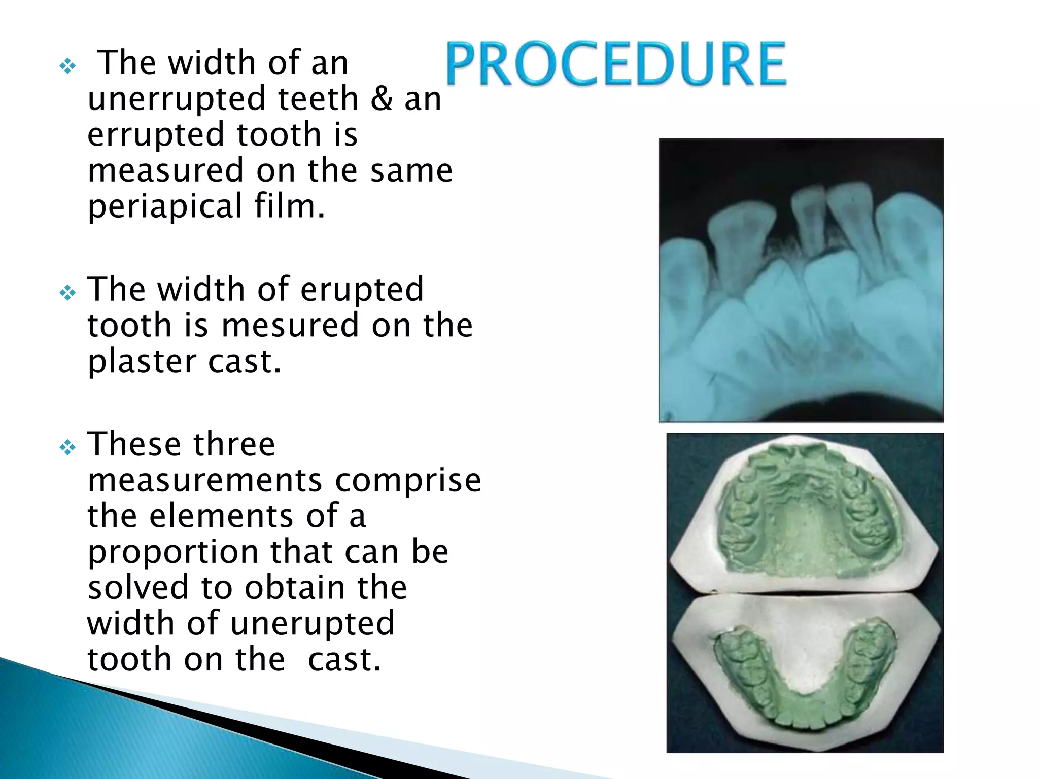 Orthodontic study model and model analysis | PPTX