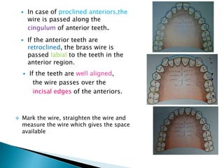 Orthodontic study model and model analysis | PPTX