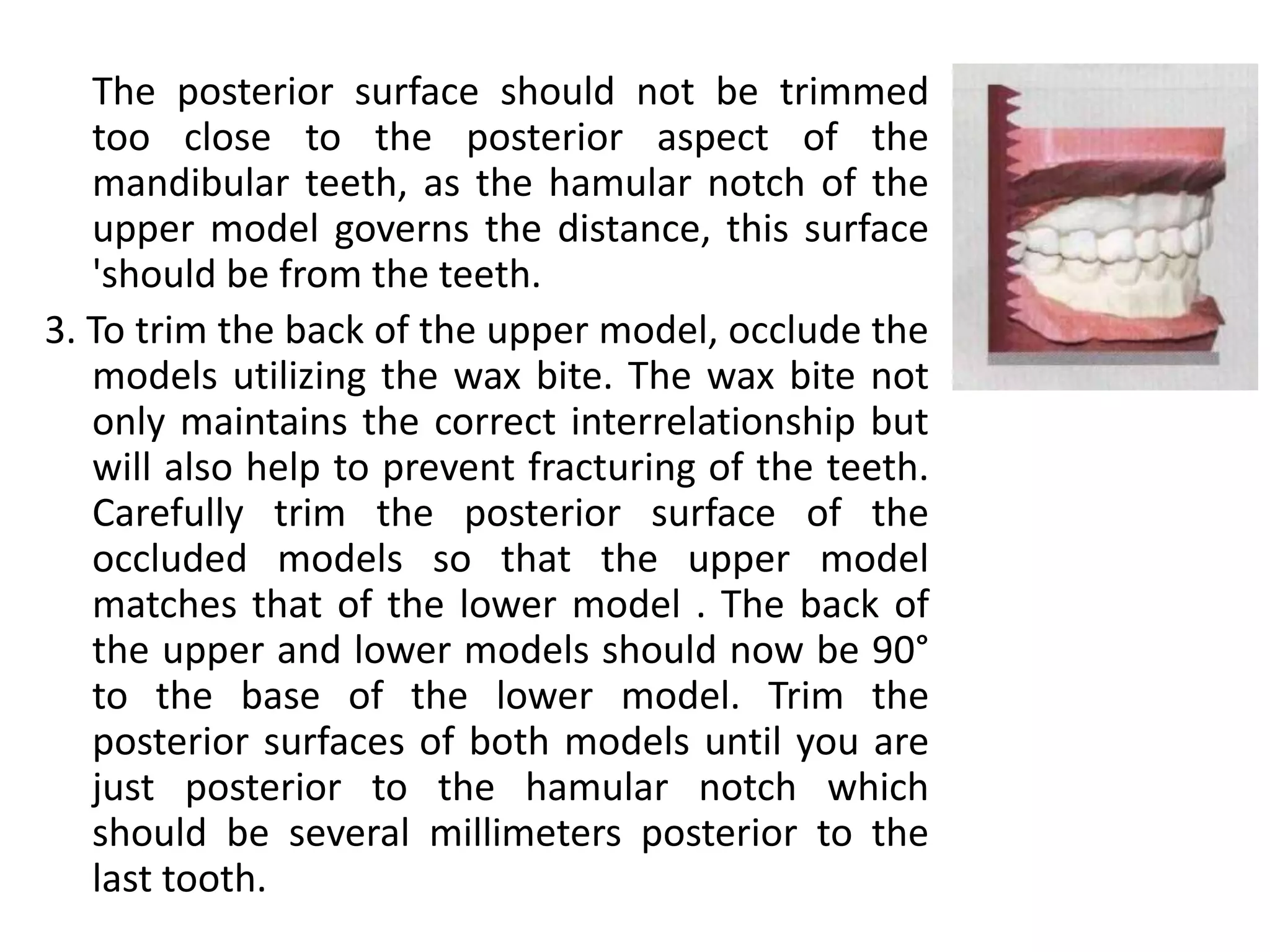 Orthodontic study models | PPT