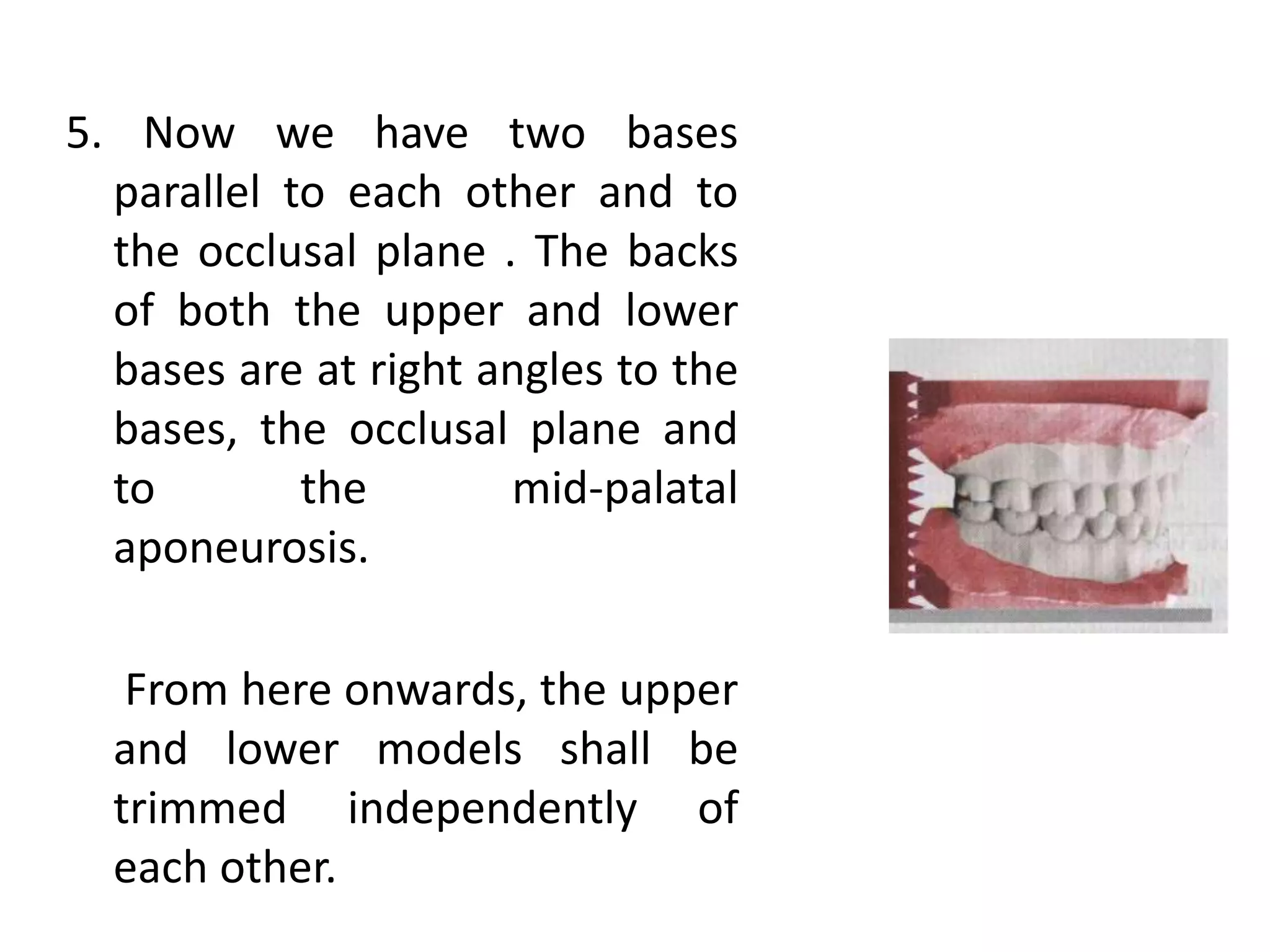 Orthodontic study models | PPT | Dental Health | Diseases and Conditions