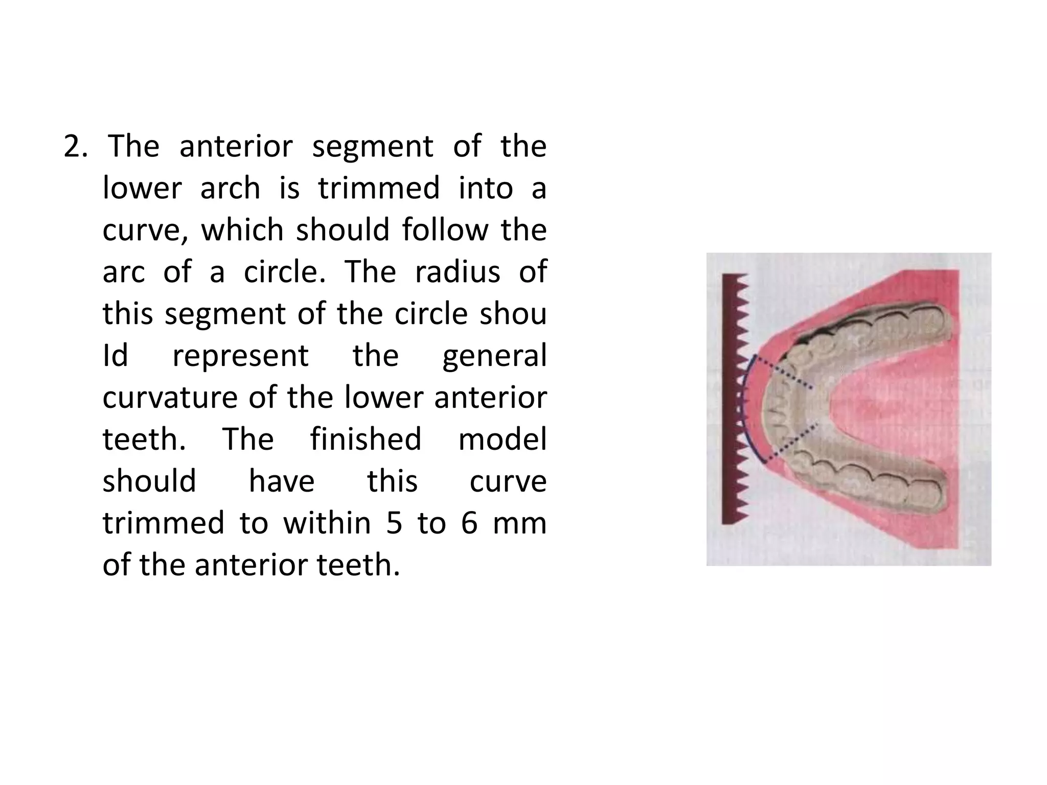 Orthodontic study models | PPT