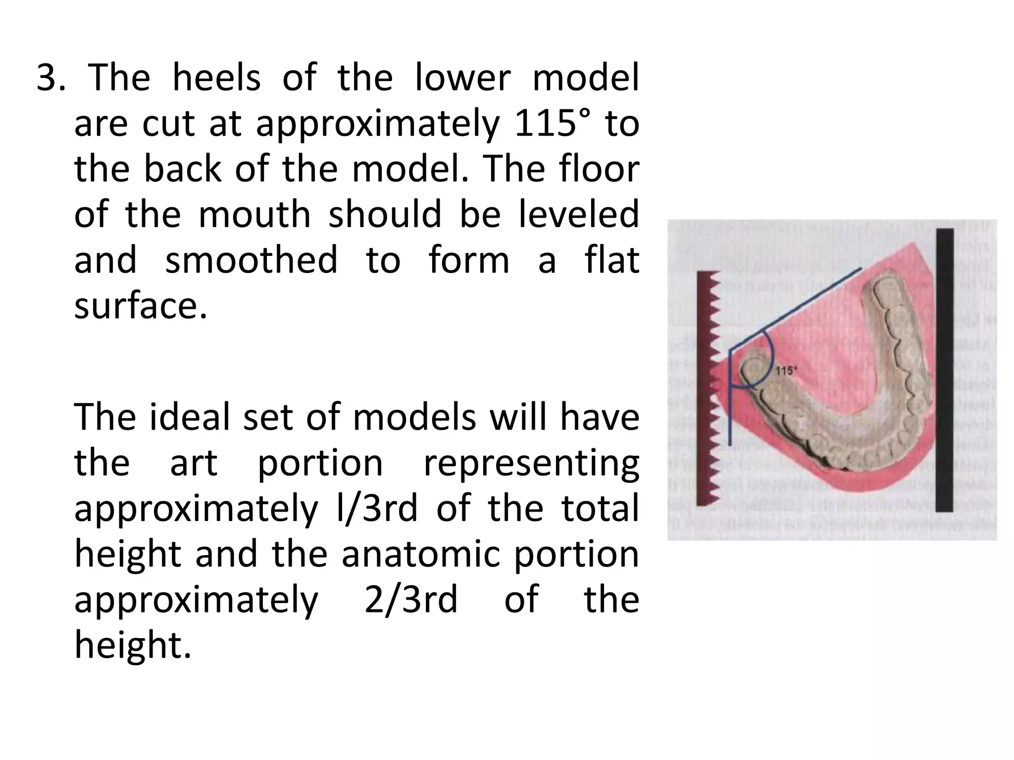 Orthodontic study models | PPT | Dental Health | Diseases and Conditions