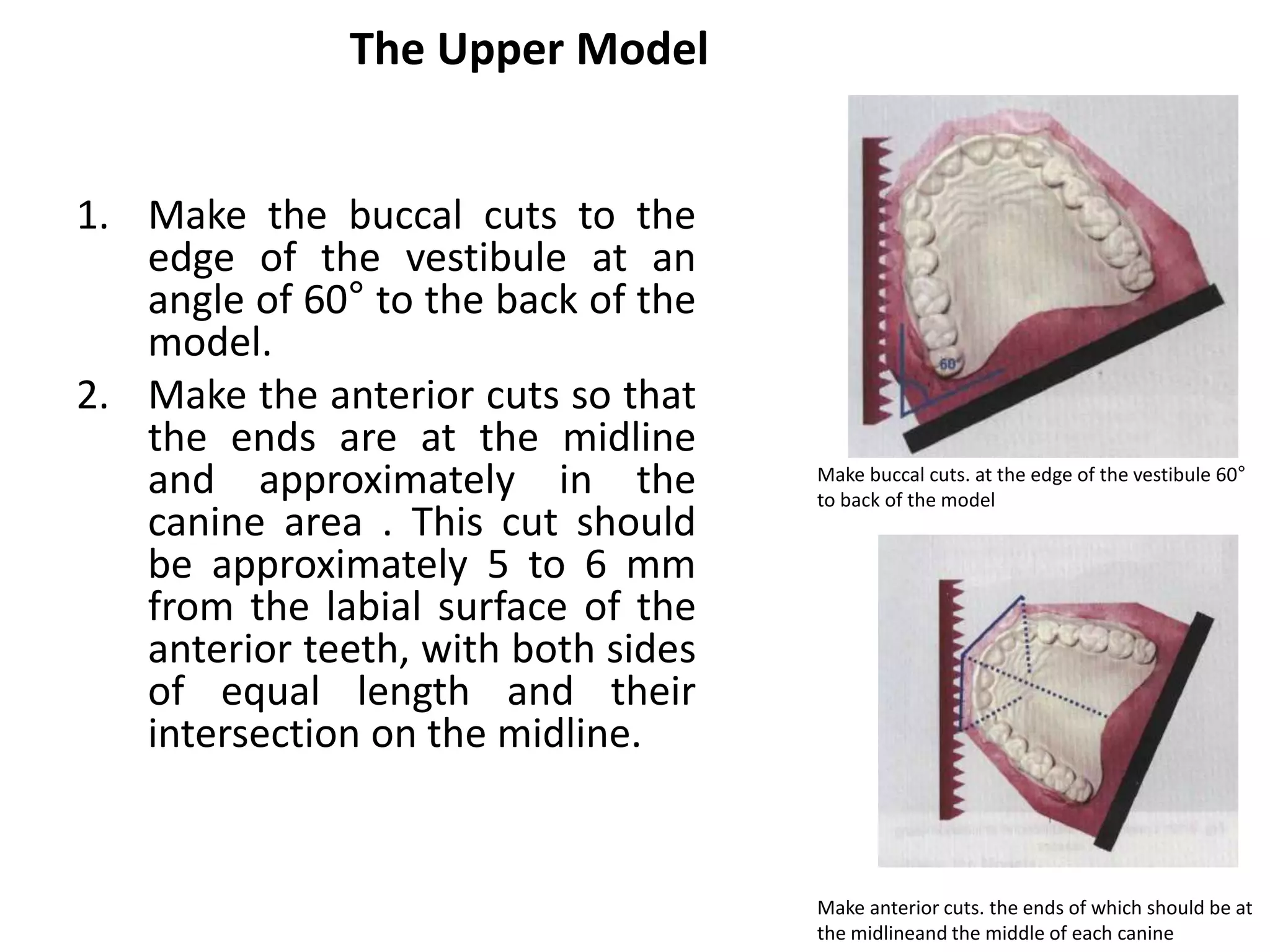 Orthodontic study models | PPT
