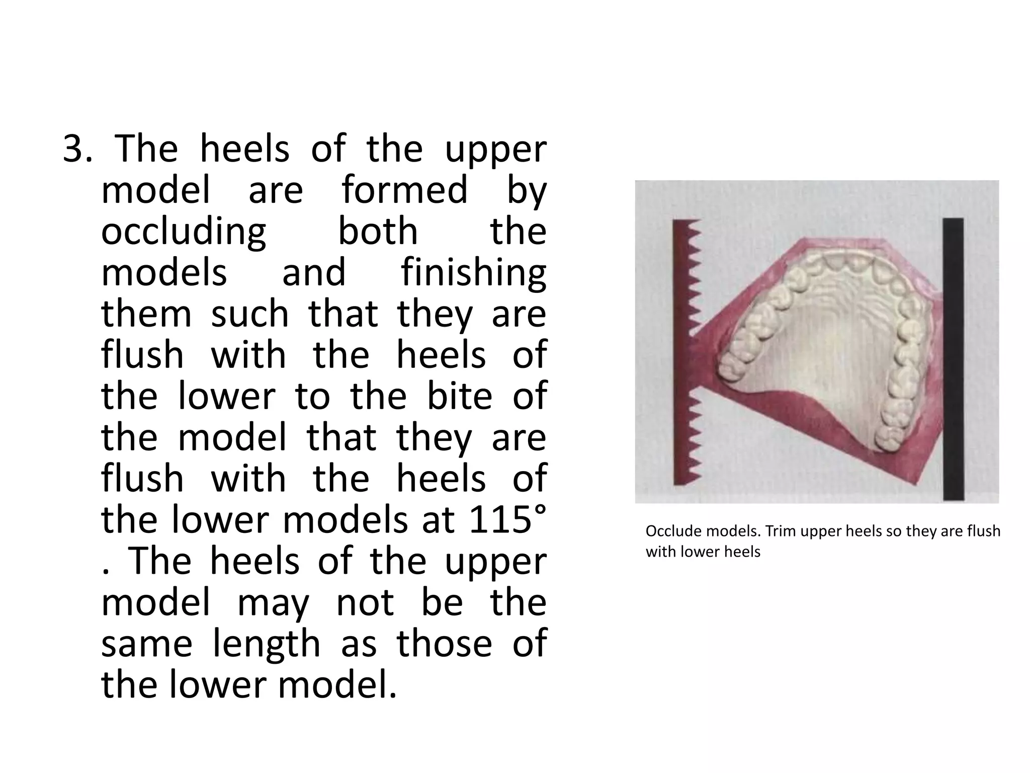 Orthodontic study models | PPT