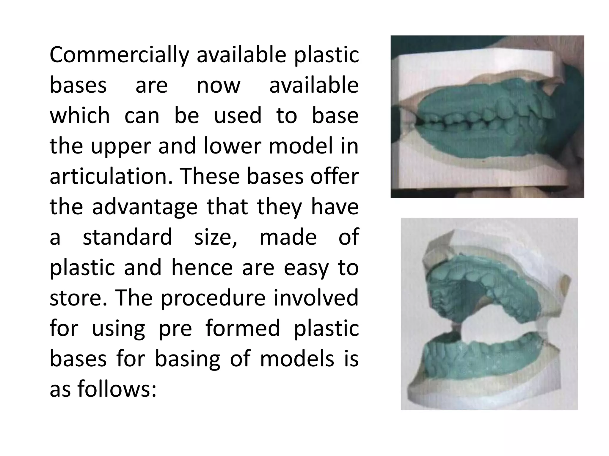 Orthodontic study models | PPT