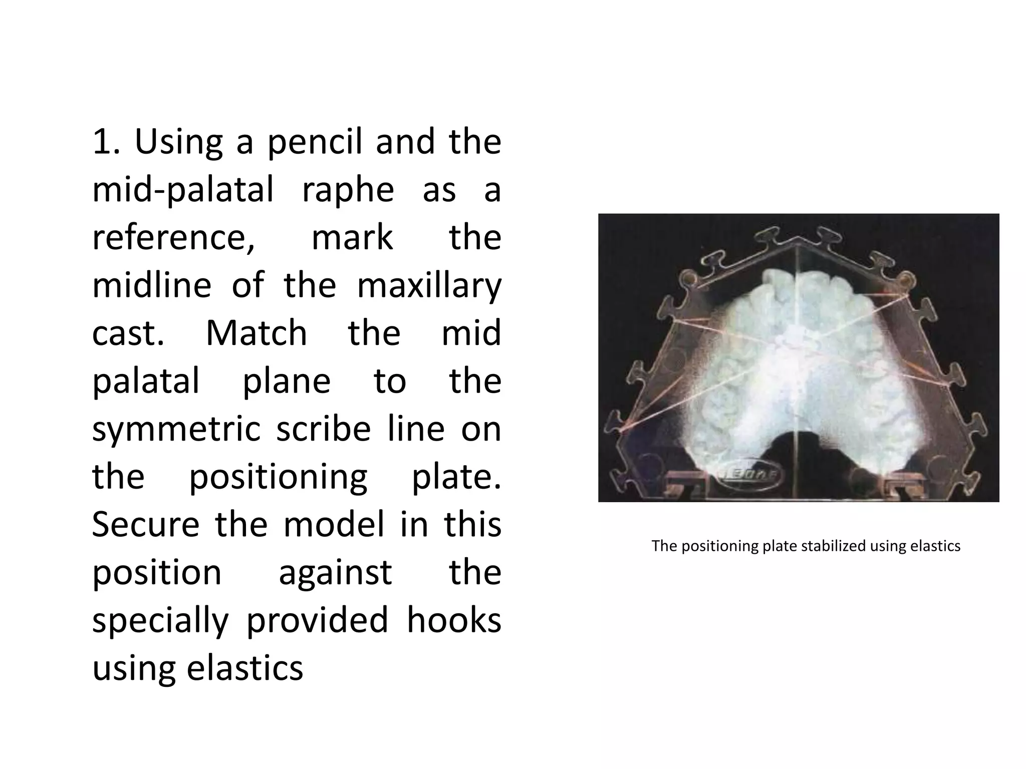 Orthodontic study models | PPT