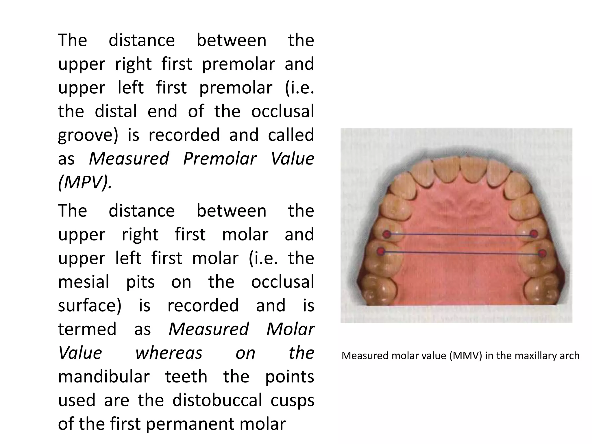 Orthodontic study models | PPT
